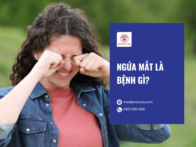 Ngứa mắt là bị gì? Nguyên nhân, dấu hiệu và cách trị